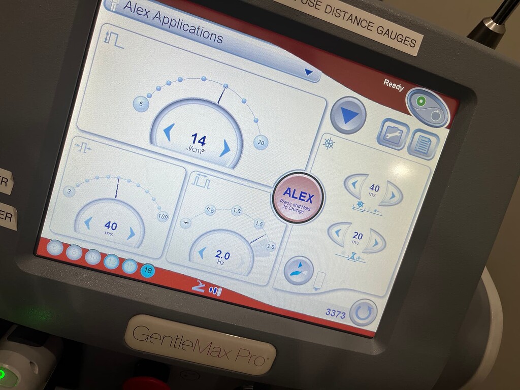 Gentle max pro, are these settings correct? It was extremely painful ...